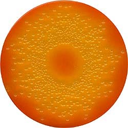 BPLS Agar (Brilliant-green Phenol-red Lactose Sucrose Agar) - Mikrobiyoloji